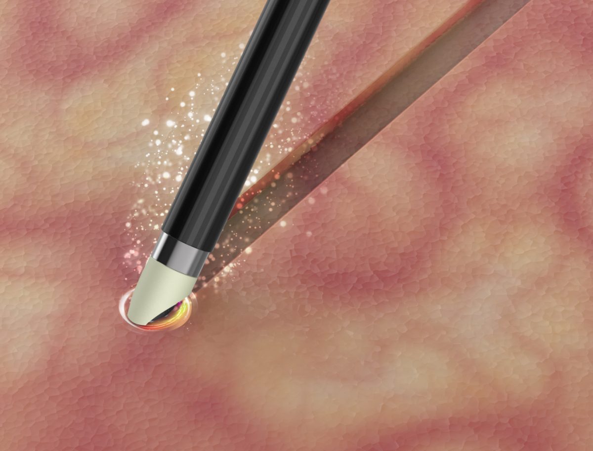 BLIX | SEAWONMEDITECH